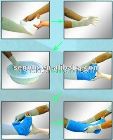 Polyester Roll Splint - Senolo Splint - Manufacturer of Senolo Medical
